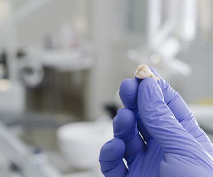 Tooth Extractions Baltimore, MD | Emergency Dentist | Baltimore Dental Arts